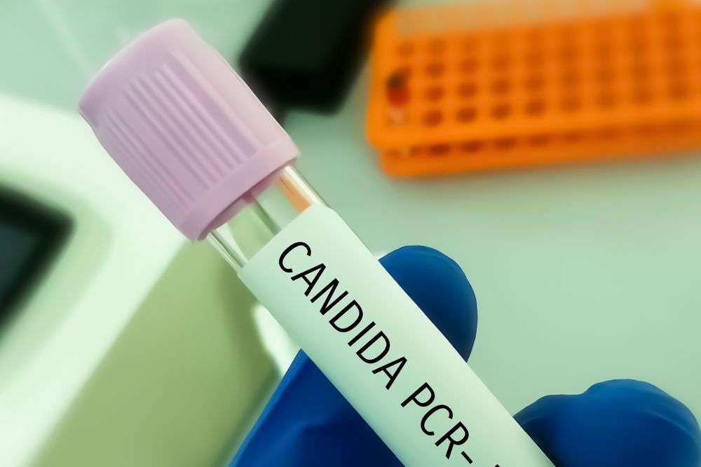 Candidíase: Sintomas, Causas, Tratamento e Transmissão